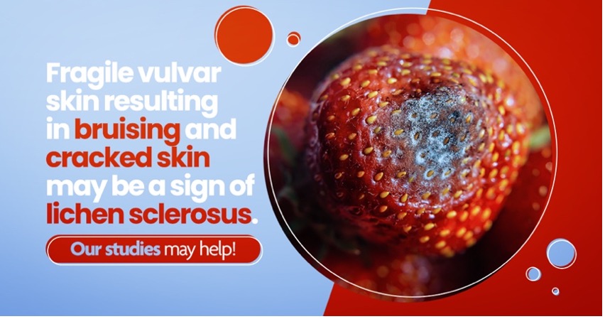 Let's Discuss Lichen Sclerosus - Seattle Clinical Research Center